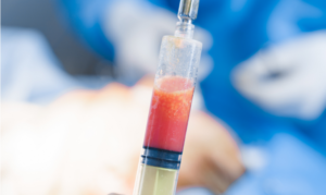 Microfat et nanofat : une révolution en médecine et en chirurgie ...